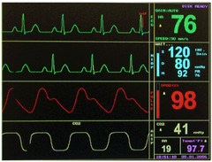 Capnography waveforms - Flashcards | StudyHippo.com