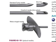 Epidural and Spinal Anesthesia - Flashcards | StudyHippo.com