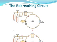 Anesthesia notes - Flashcards | StudyHippo.com