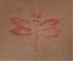 Dermatology pictures | StudyHippo.com