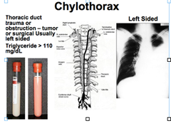 Chest Tube Management - Flashcards | StudyHippo.com