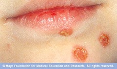 Dermatology terms | StudyHippo.com