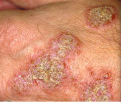 Dermatology pictures | StudyHippo.com