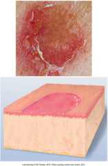 Dermatology terms | StudyHippo.com