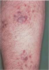 Dermatology pictures | StudyHippo.com