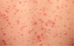 Dermatology pictures | StudyHippo.com