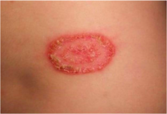 Dermatology pictures | StudyHippo.com