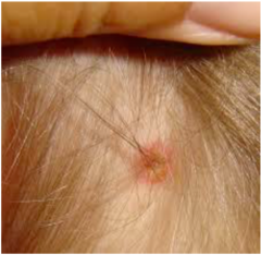 Dermatology pictures | StudyHippo.com