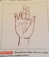 Hand & UE | StudyHippo.com